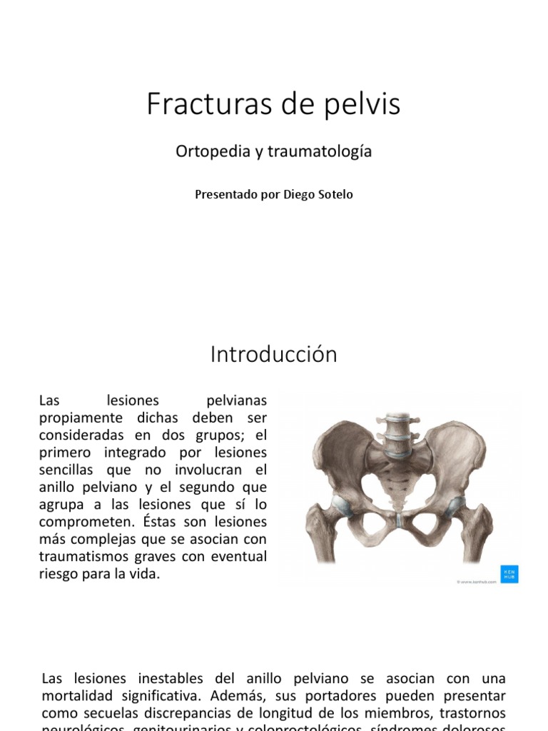 Fracturas de Pelvis | PDF | Pelvis | Sistema musculoesquelético
