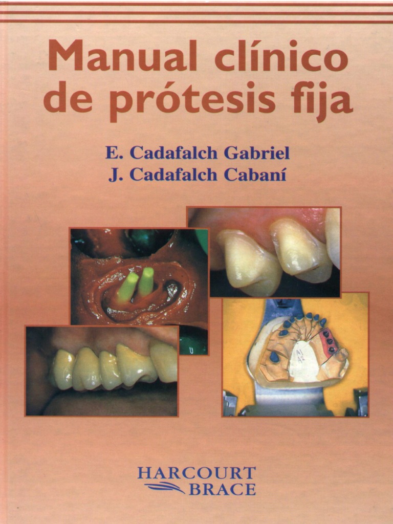 Manual Clínico de Prótesis Fija de Cadafalch | PDF