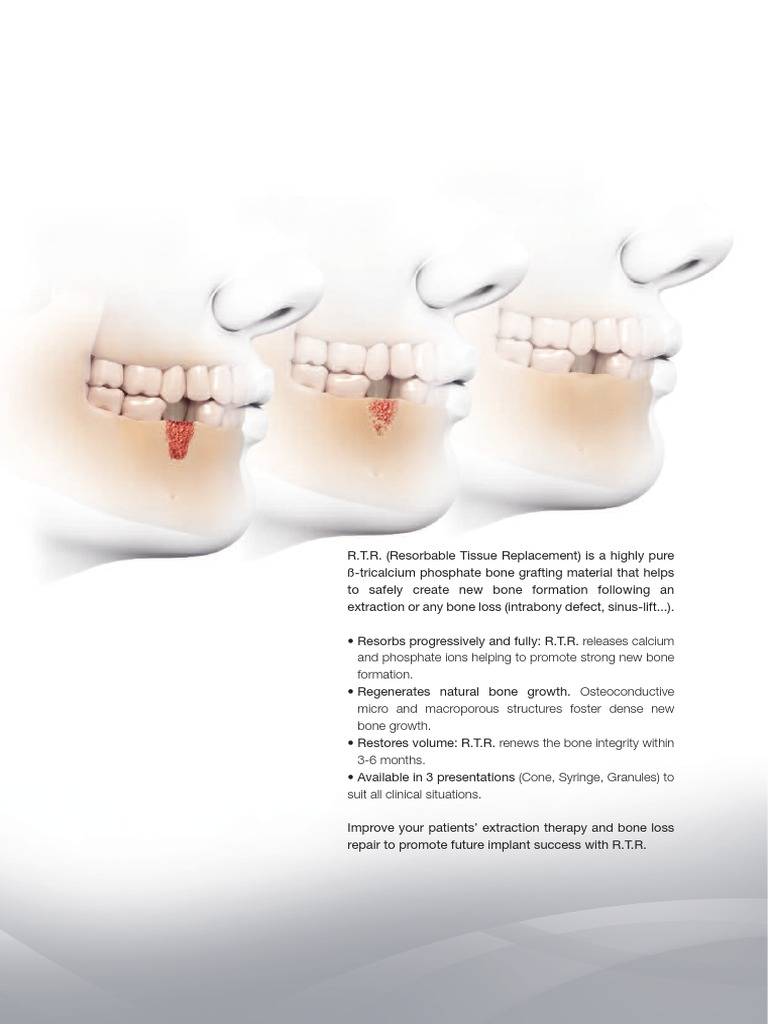 RTR Dentist Brochure 22022013 | PDF | Bone | Medical Specialties