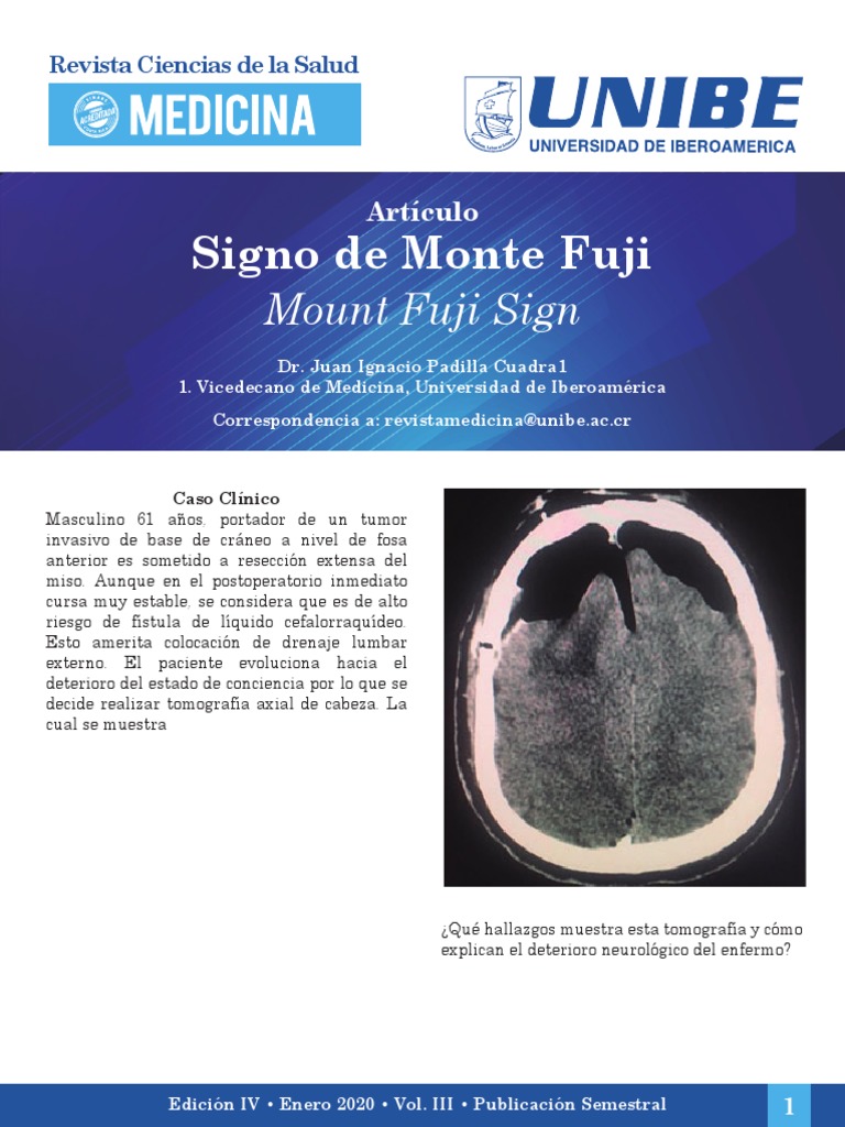 Signo de Monte Fuji en Tomografía | PDF | Medicina CLINICA ...