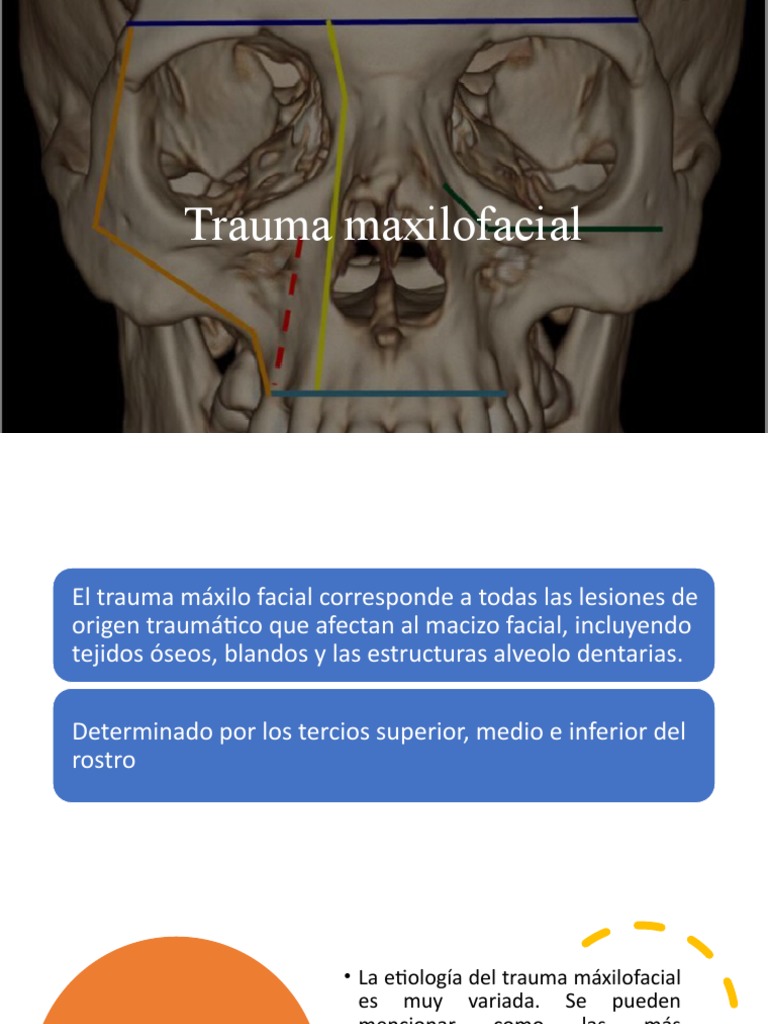 Trauma Maxilofacial | PDF | Lesión | Cara