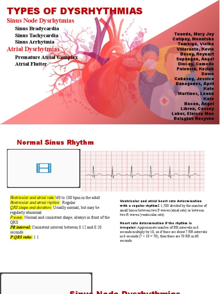 Types of Dysrhythmias | PDF | Heart Rate | Heart