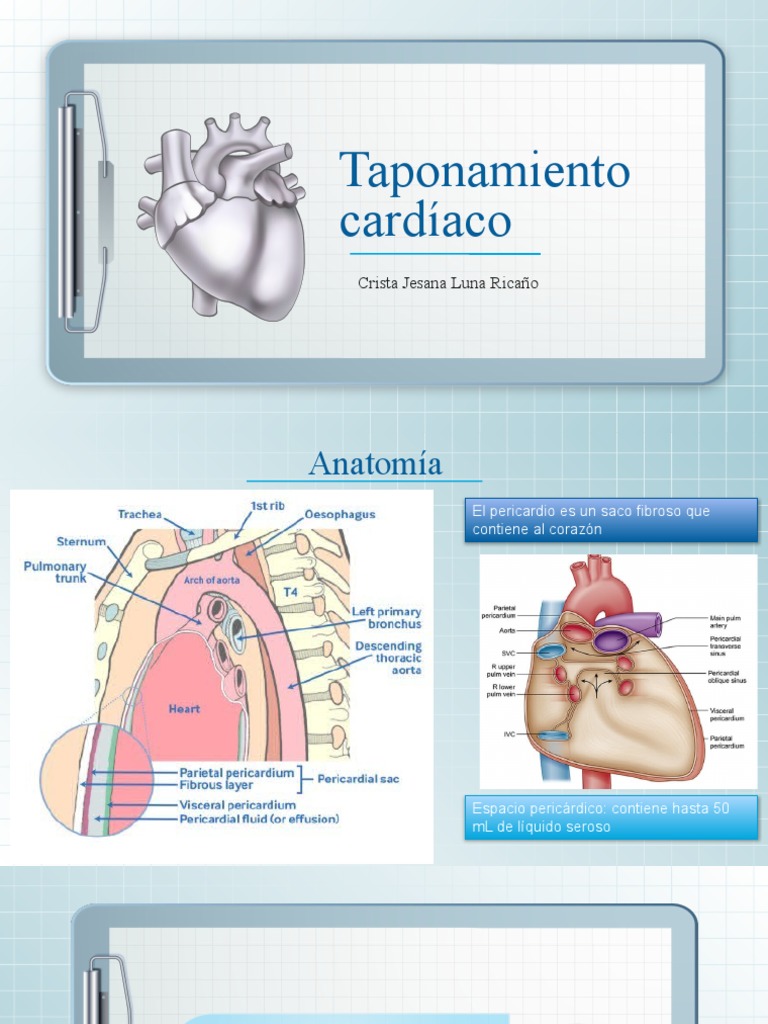 Taponamiento cardíaco | PDF | Enfermedades y trastornos humanos | Corazón