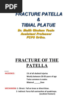 Posterior Tibial Tendon Insufficiency (PTTI) - Foot & Ankle ...