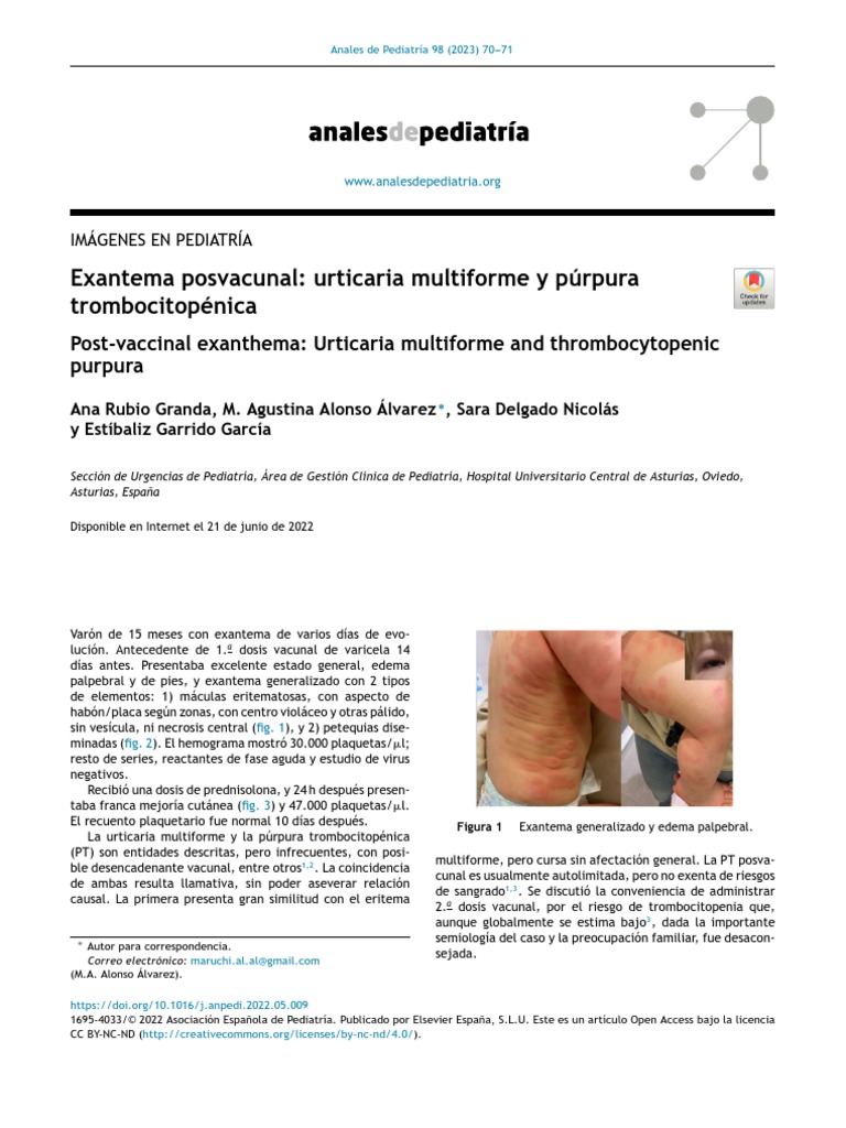Exantema Posvacunal: Urticaria Multiforme y Púrpura Trombocitopénica ...