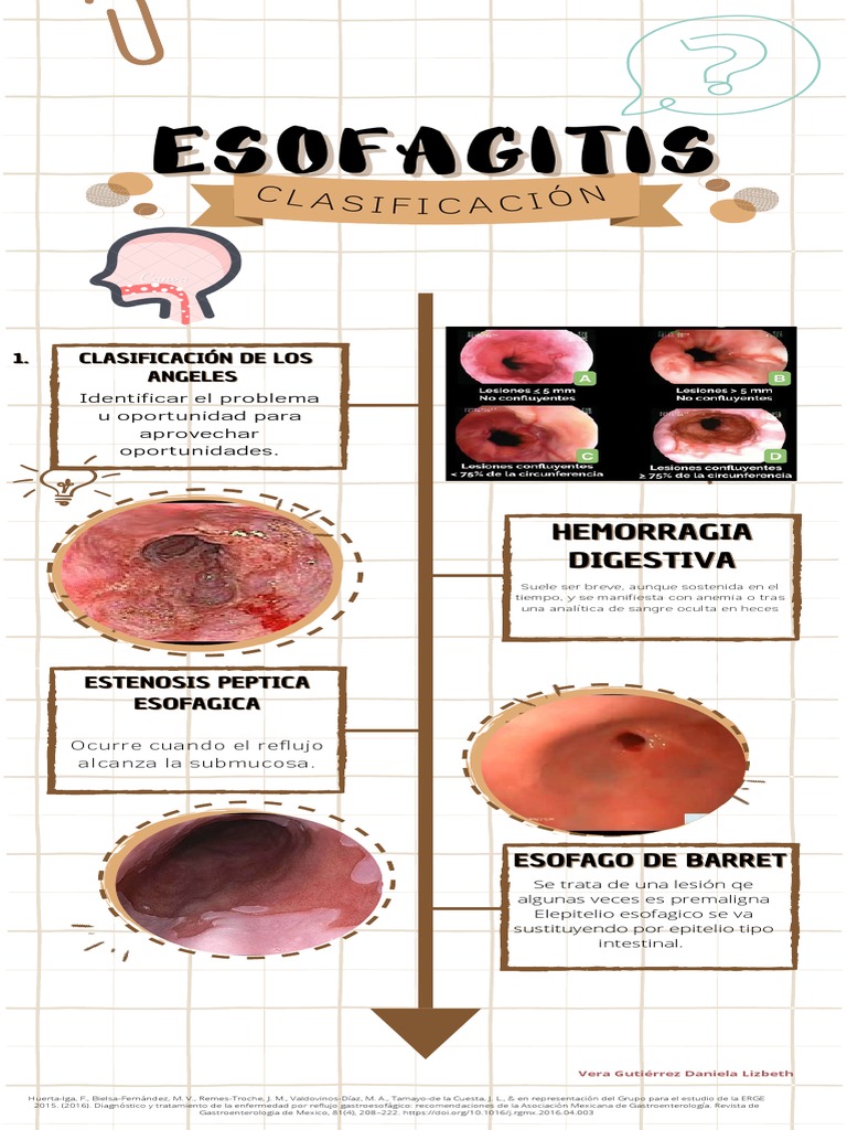 Clasificación de la esofagitis de Los Ángeles | PDF | La enfermedad por ...