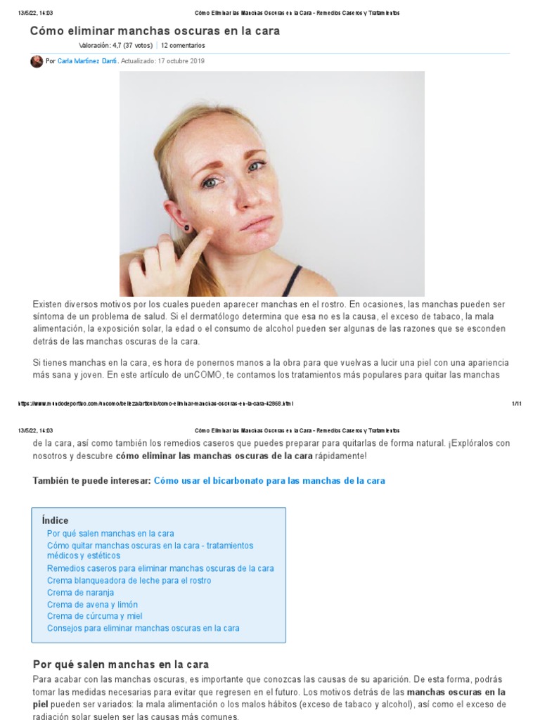 Cómo Eliminar Las Manchas Oscuras en La Cara - Remedios Caseros y Tratamientos | PDF | Leche ...