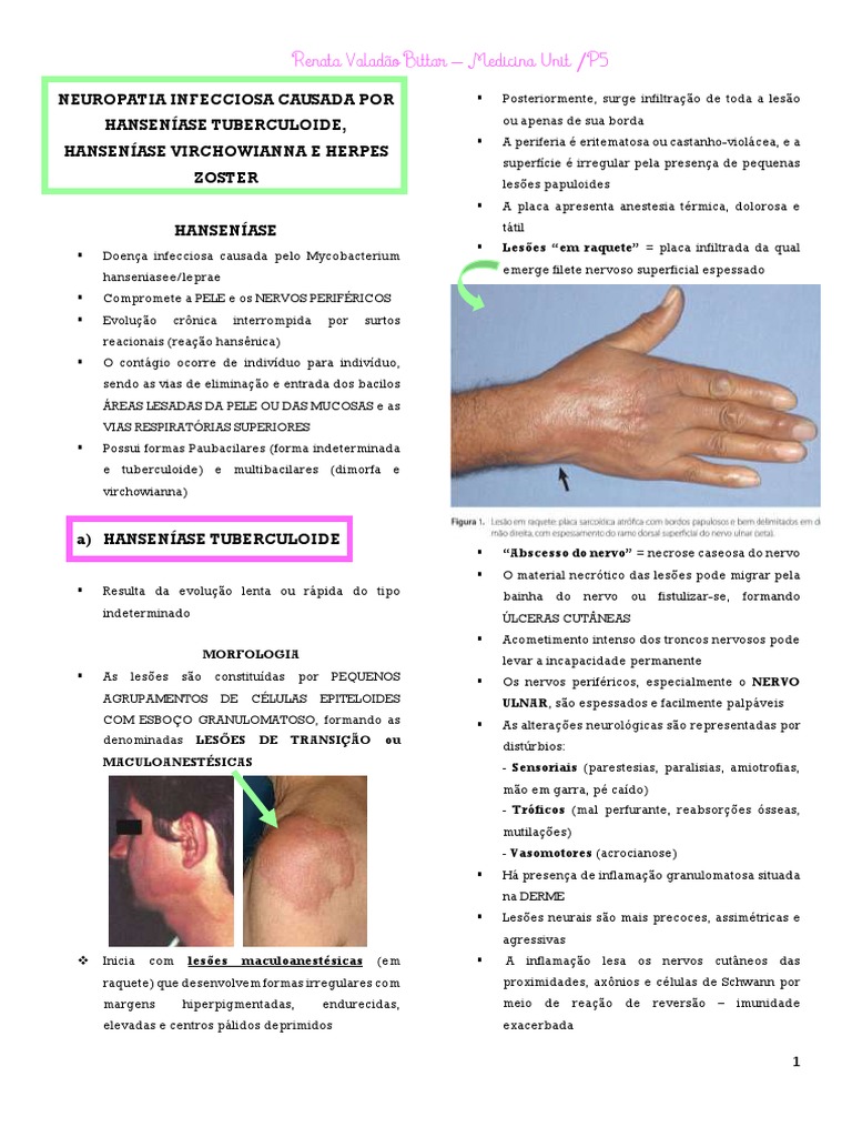 Neuropatia Infecciosa: Hanseníase e Herpes | PDF | Lepra | Nervo