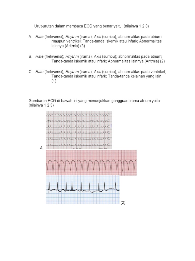 Soal Normal and Abnormal ECG Reading | PDF