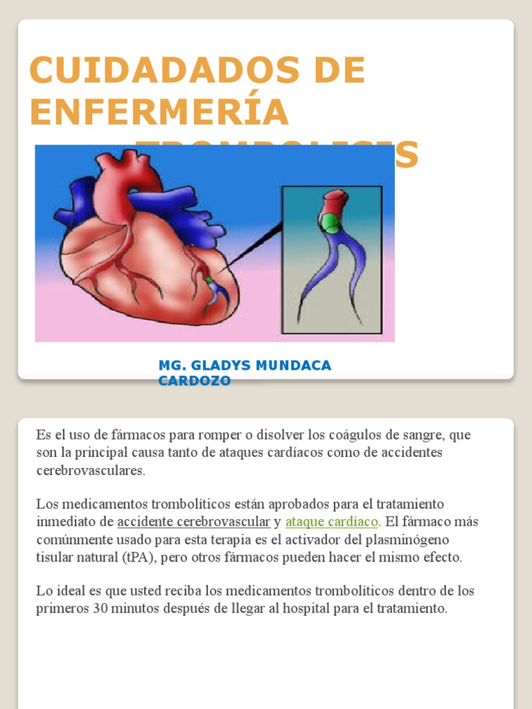 Ateencion Enfermeria Trombolisis - PPTX Versión 1 | PDF