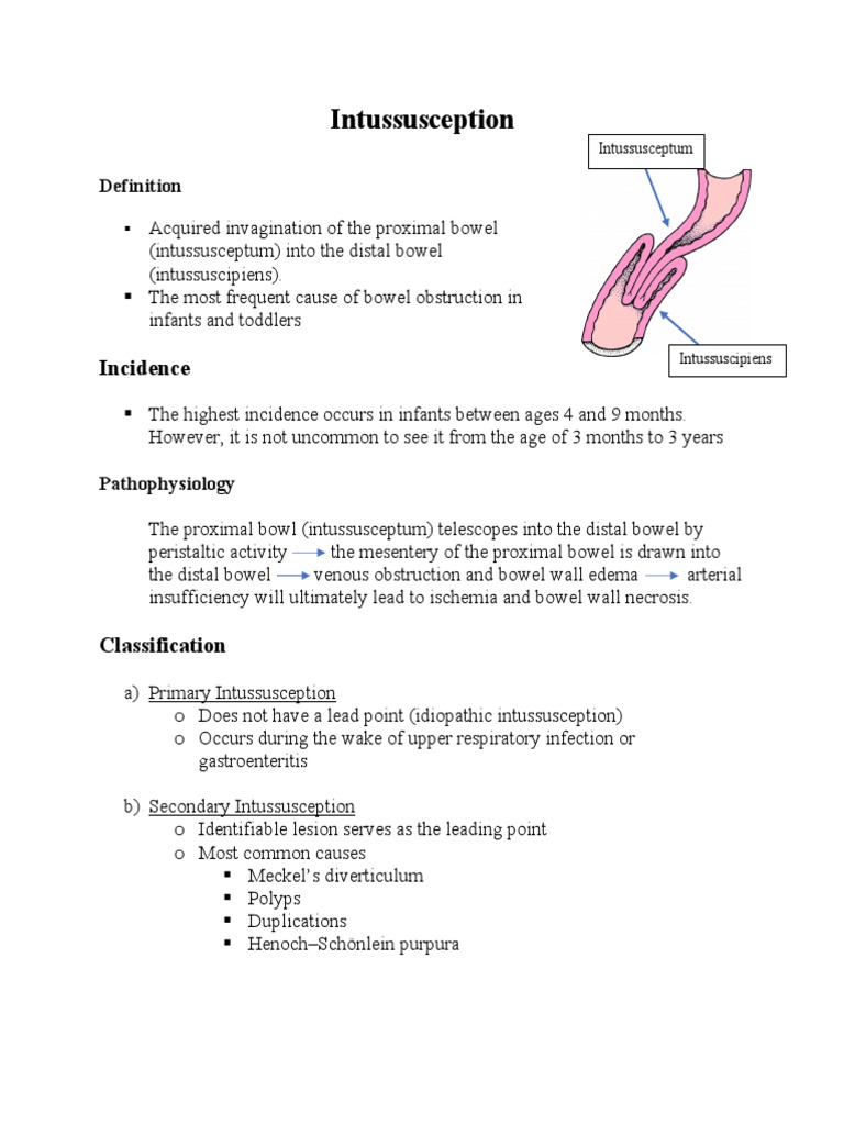 Intussusception | PDF | Human Diseases And Disorders | Epidemiology