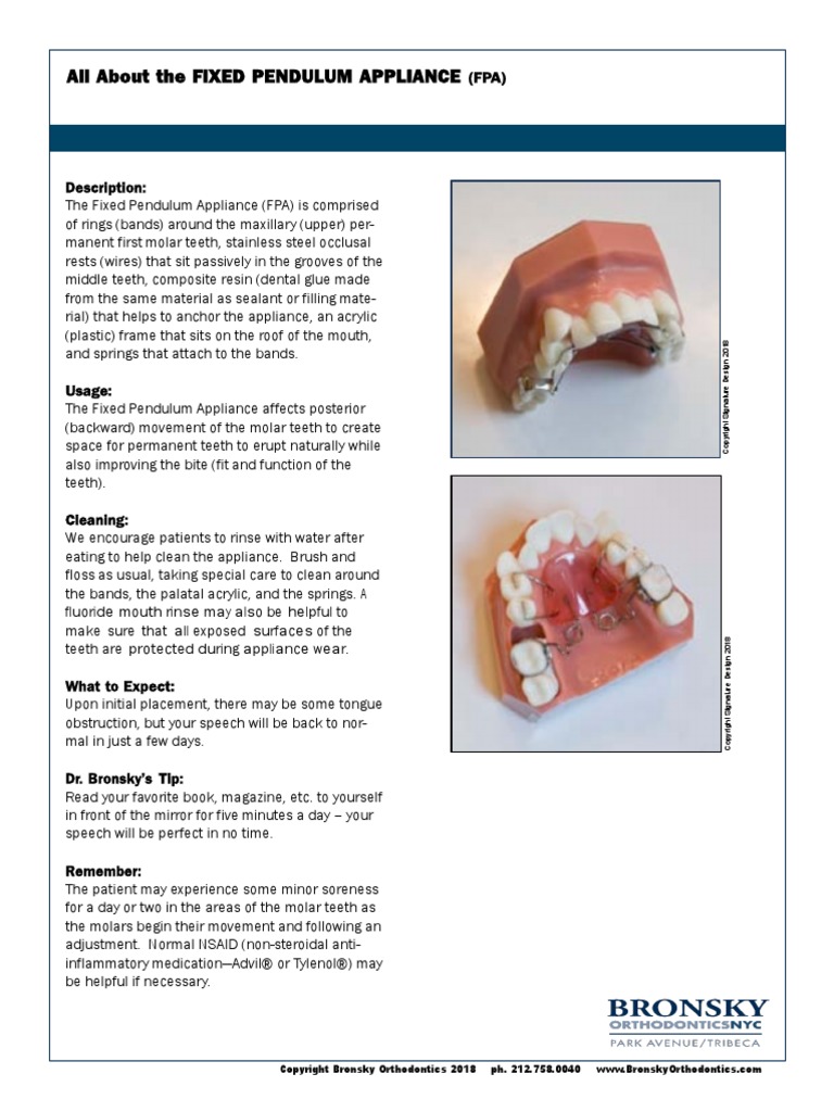 All About The FIXED PENDULUM APPLIANCE FPA | PDF