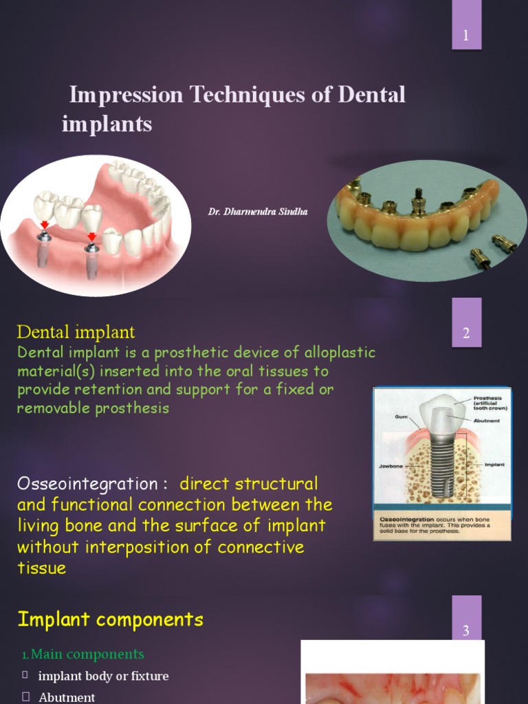 Dental Implant Impression Techniques | Download Free PDF | Dental ...
