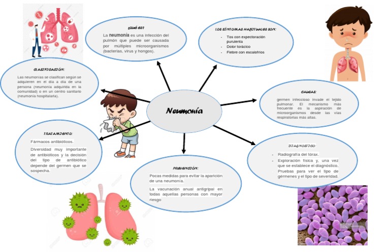 Mapa Conceptual Neumonia | PDF | Neumonía | Enfermedades respiratorias