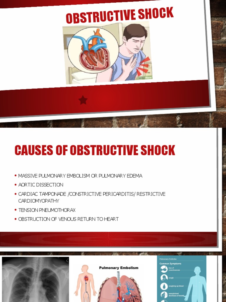 Obstructive Shock Final Edit | PDF | Thorax | Medical Specialties