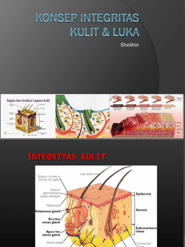 Konsep Integritas Kulit & Luka New | PDF