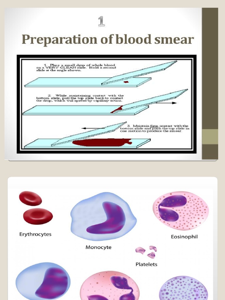 Blood Smear Staining | PDF
