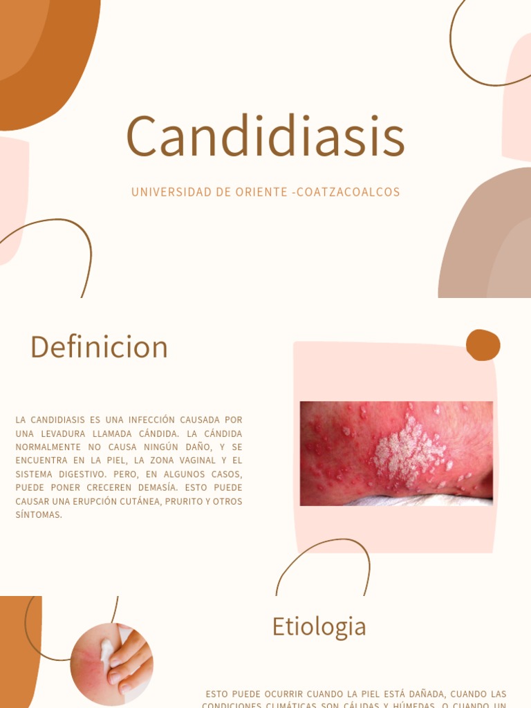 Candidiasis | PDF