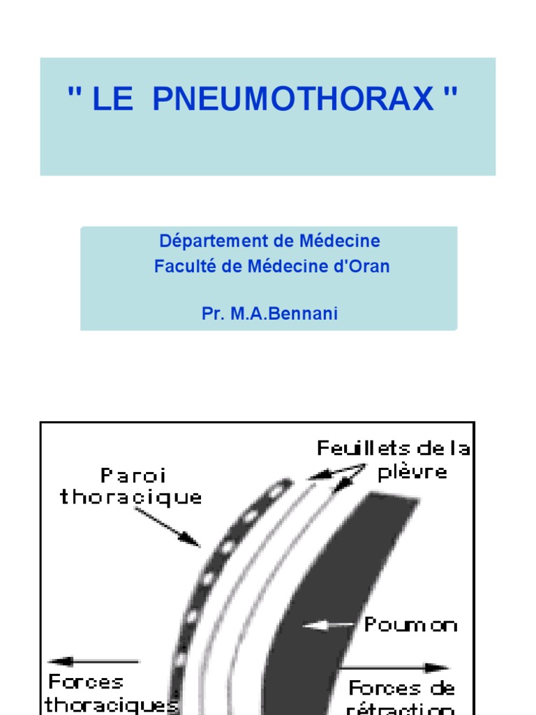 Pneumothorax | PDF | Poumon | Maladie respiratoire