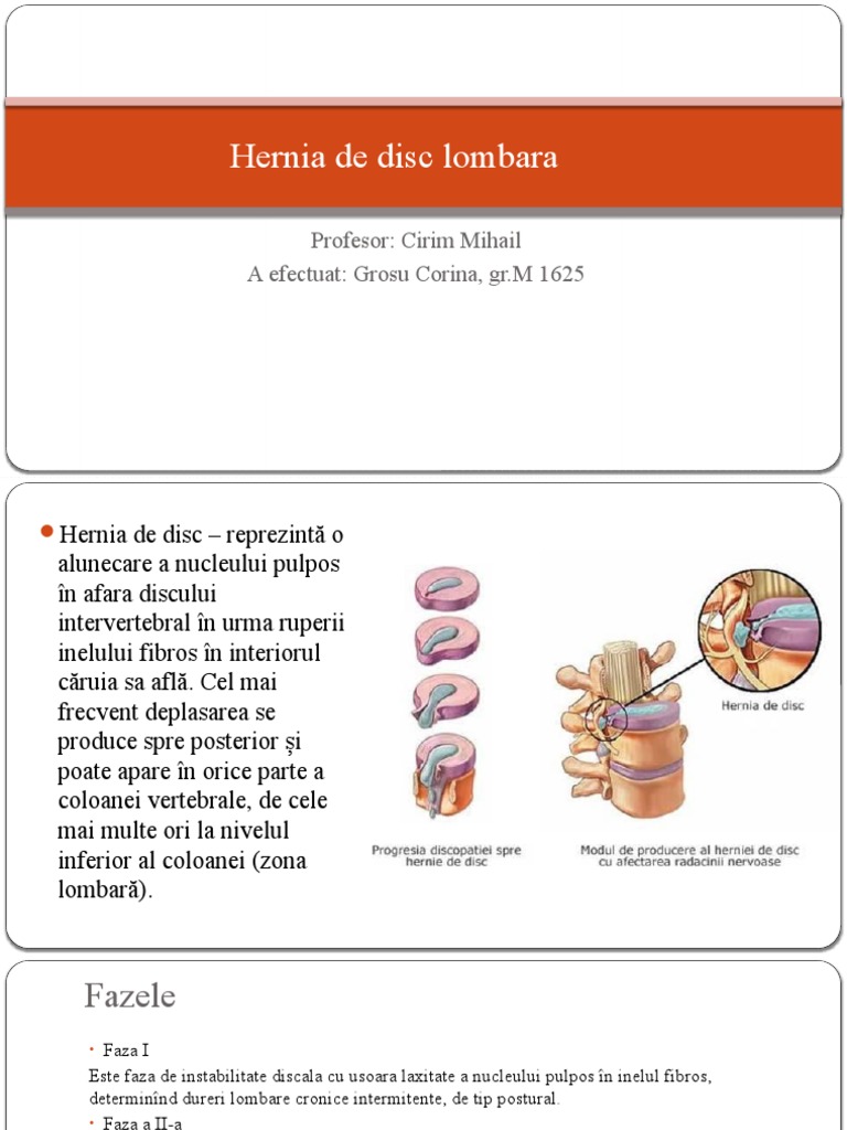 Hernie | PDF