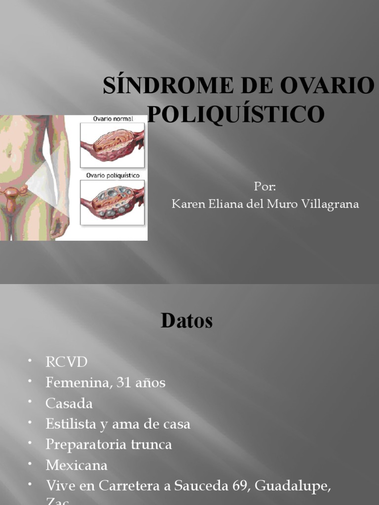 Síndrome de Ovario Poliquístico | PDF | Ciclo menstrual | Ovario