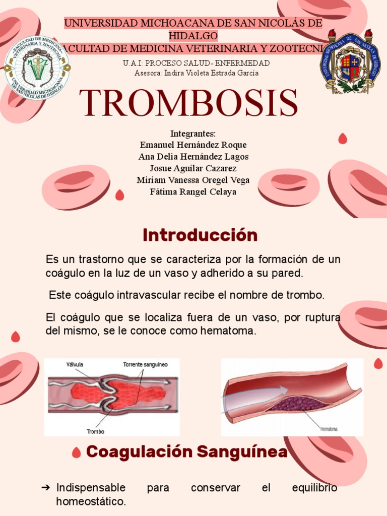 Trombosis | PDF | Coagulación | Plaqueta