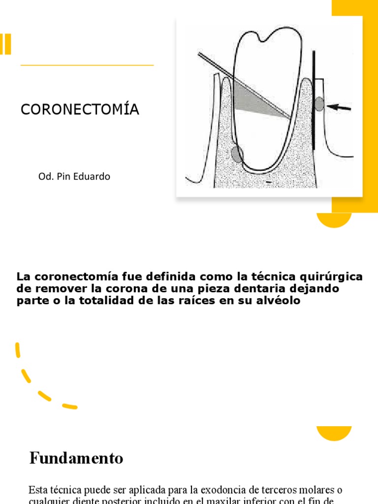 CORONECTOMIA | PDF | Medicina CLINICA | Especialidades Medicas