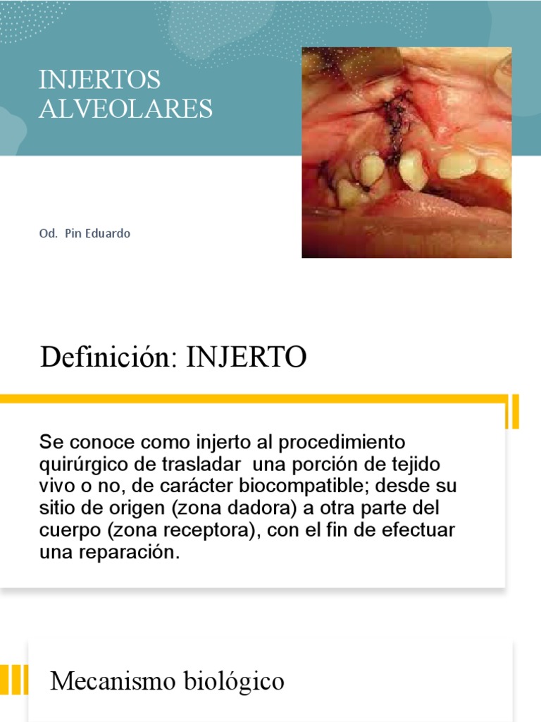 Definición y tipos de injertos óseos | PDF | Hueso | Especialidades Medicas