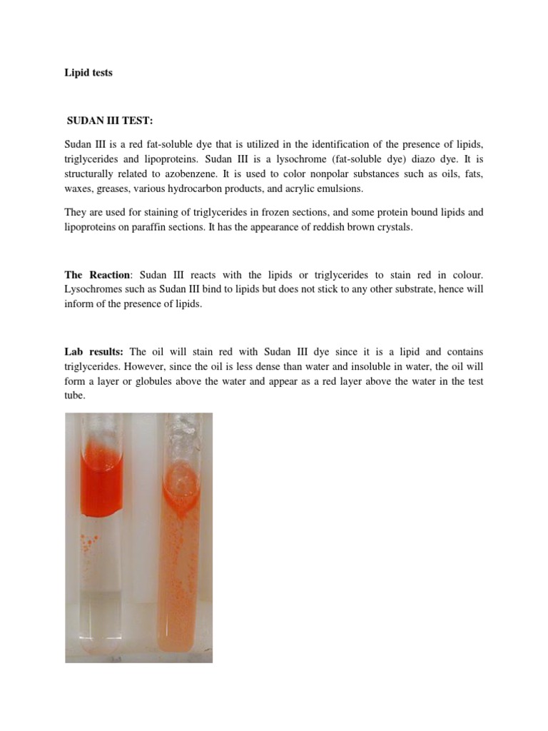 Sudan III Test for Lipid Detection | PDF