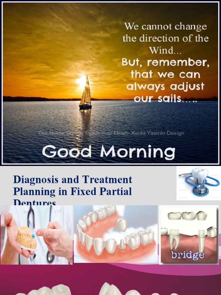 Diagnosis and Treatment Planning in FPD | PDF | Dental Implant ...