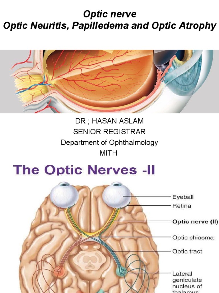 Optic Nerve Disorders Overview | PDF | Retina | Clinical Medicine