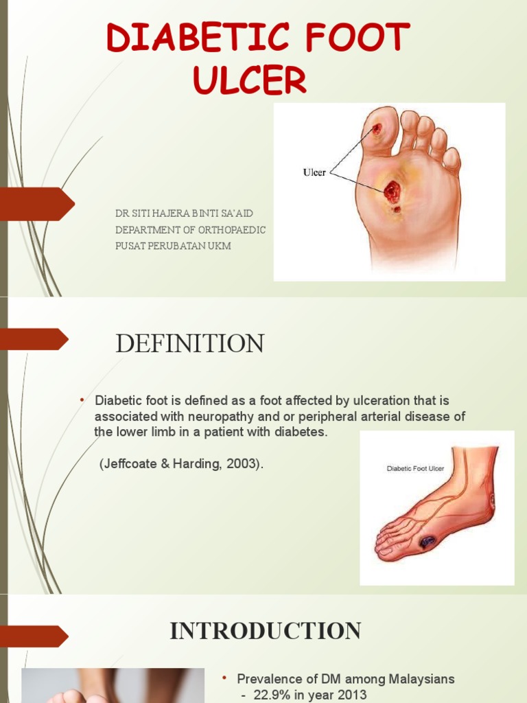 Understanding Diabetic Foot Ulcers | PDF | Peripheral Neuropathy | Wound