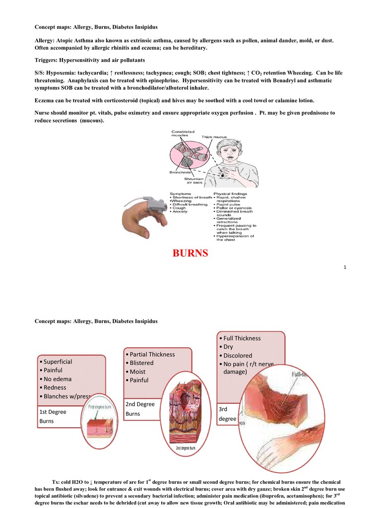 Concept Map Allergy, Burns, DI | PDF | Wellness | Science & Mathematics
