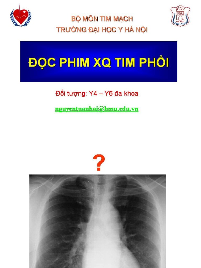 Phim XQ Trong Tim Mach | PDF