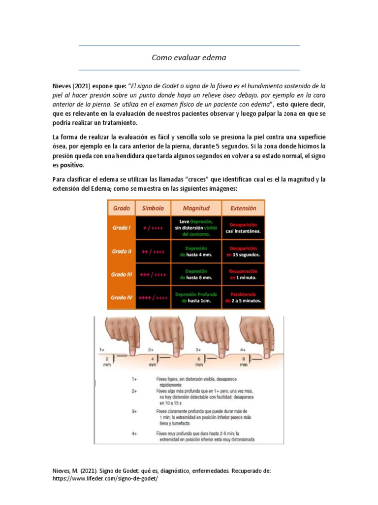 Signo Fovea o Godet Recopilación | PDF