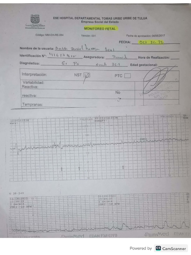 Monitoreo Fetal | PDF