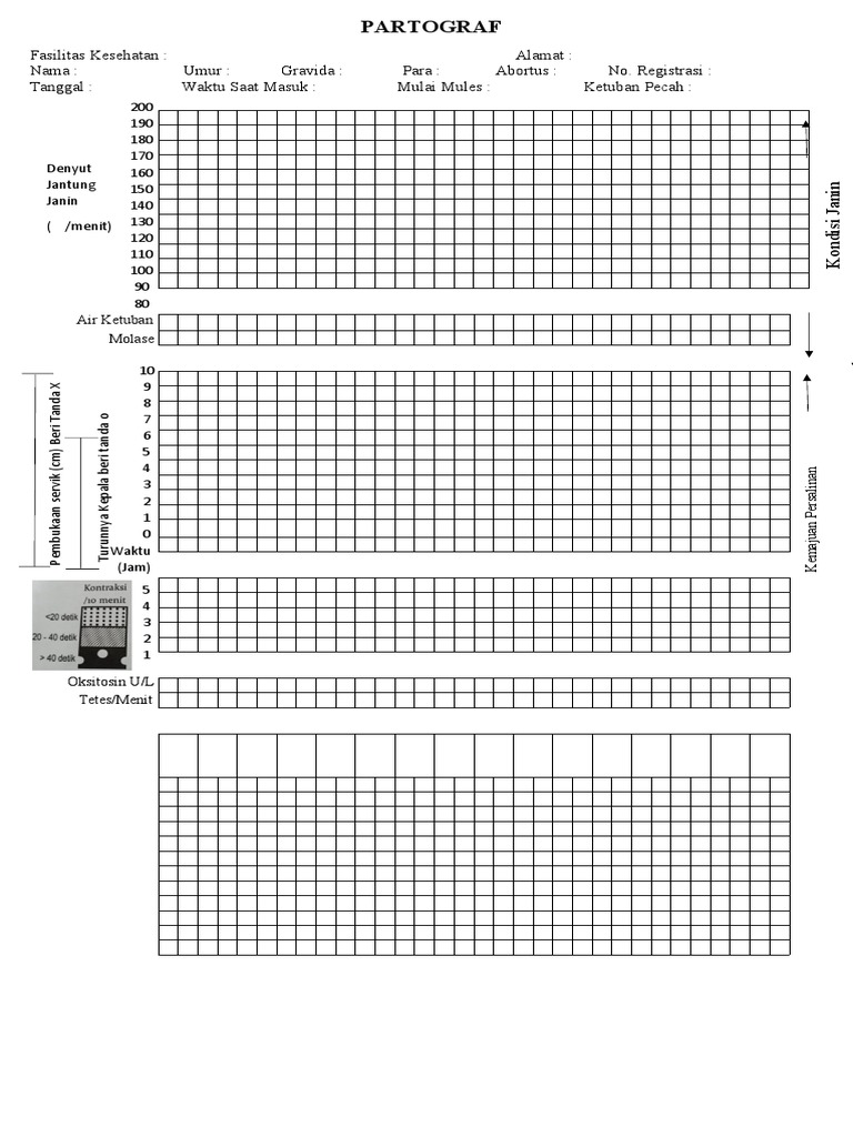 Panduan Penggunaan Partograf | PDF