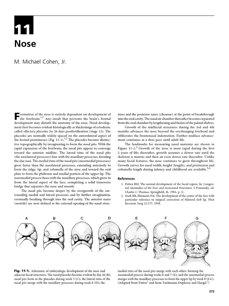 Human Malformations - 11 - Nose | PDF