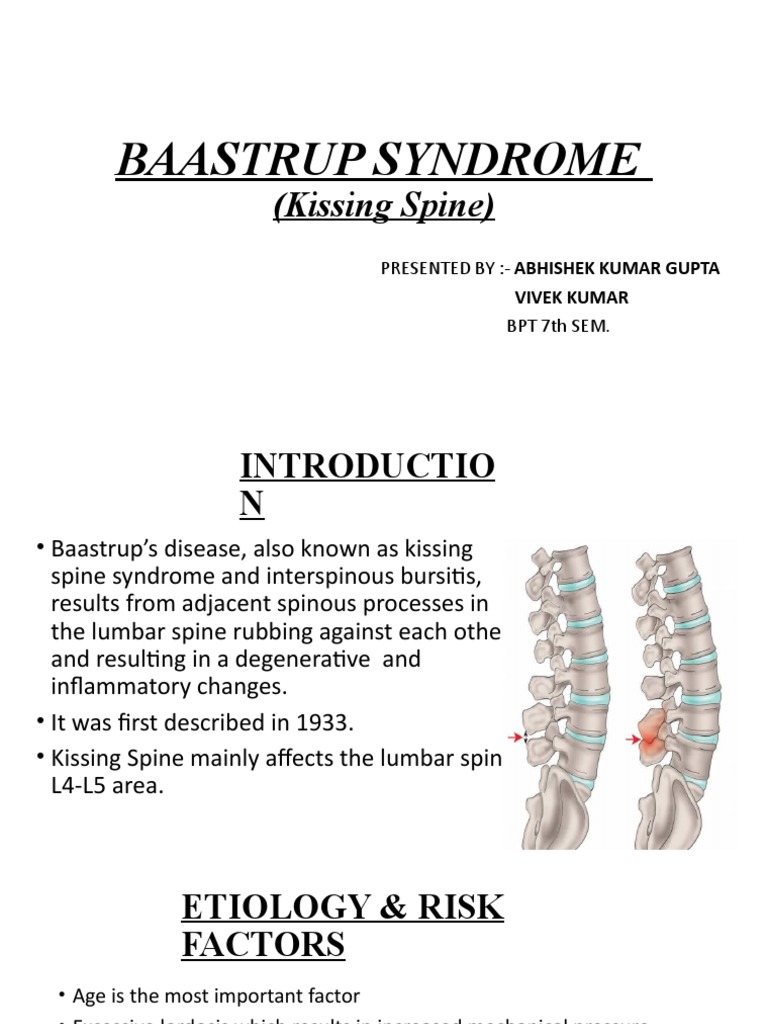 Understanding Baastrup's Syndrome | PDF | Self-Improvement | Wellness