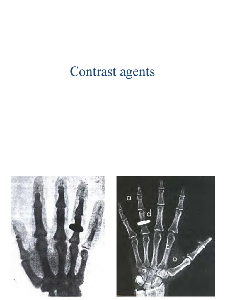 Contrast Agents in Medical Imaging: Properties, Uses, and Complications ...