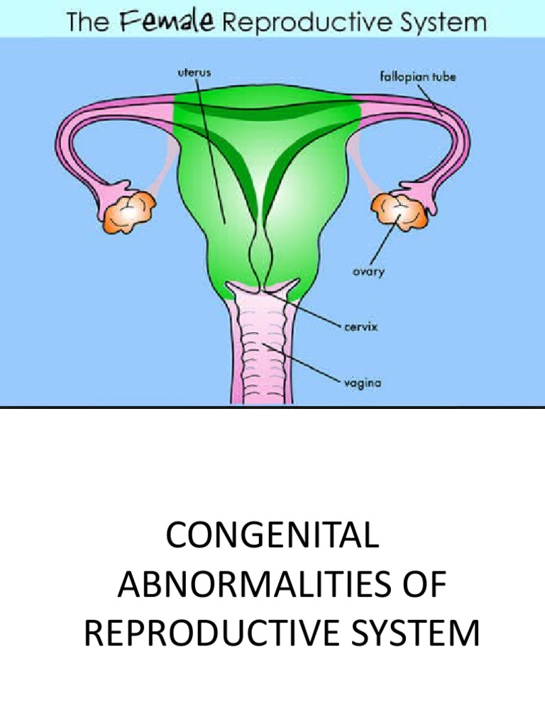 2 Congenital Abnormalities Pdf Vagina Uterus