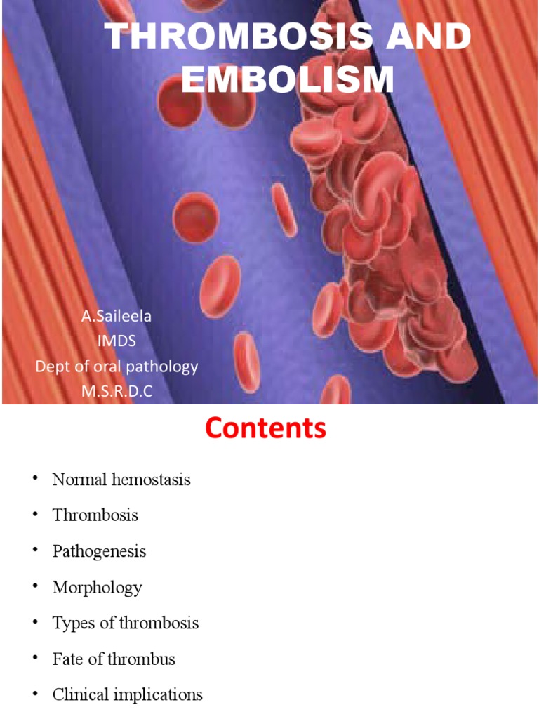 Thrombosis and Embolism | PDF | Thrombosis | Embolism