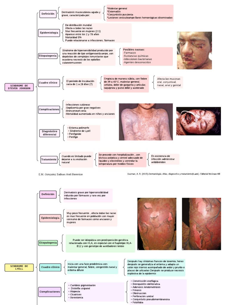 Síndrome de Stevens-Johnson: Causas y Tratamiento | PDF | Medicina CLINICA | Enfermedades y ...