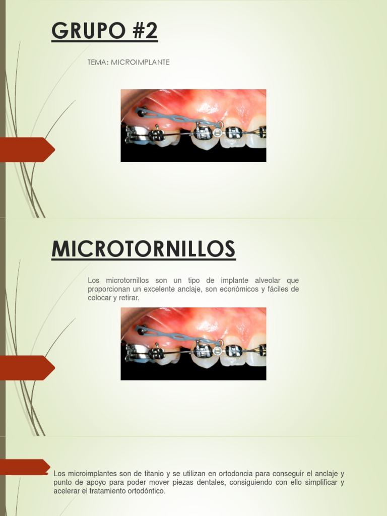 MICROIMPLANTES | PDF | Implante dental | Tornillo