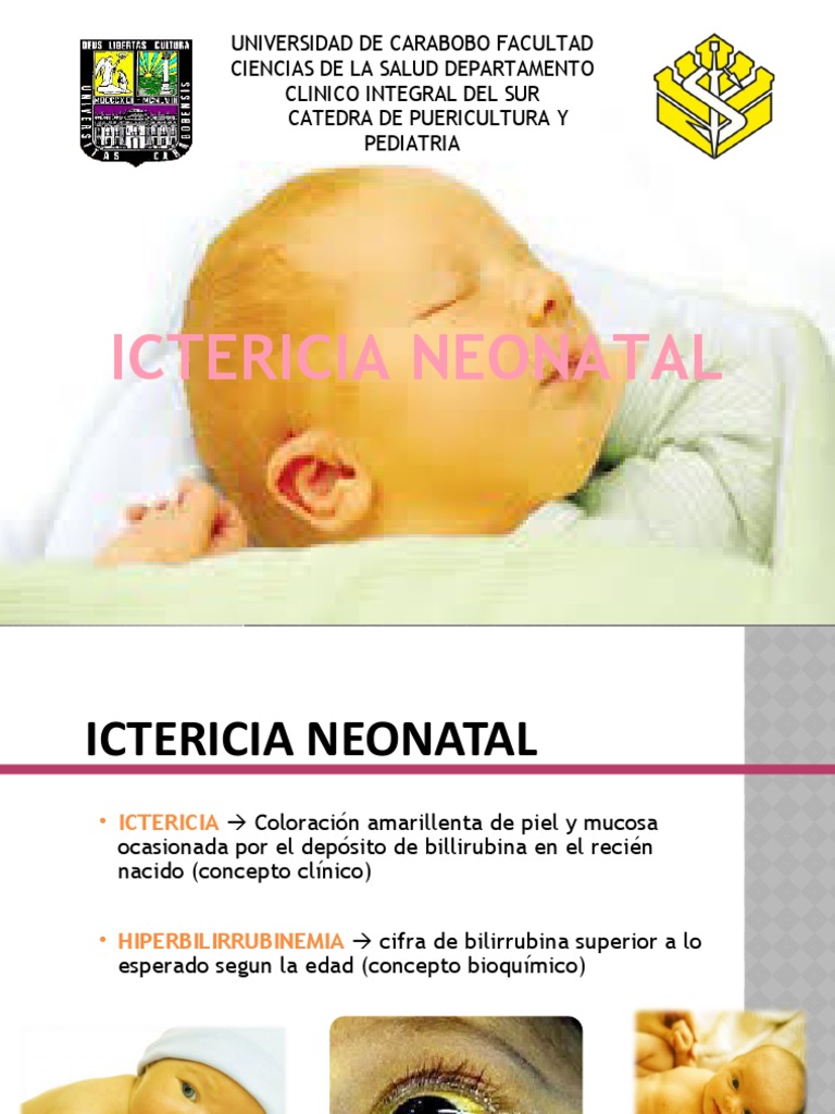 Ictericia Neonatal Causas Mecanismos Y Tipos Pdf Especialidades