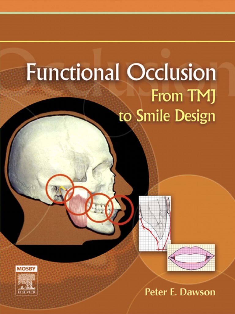Oclusion Funcional DAWSON | PDF