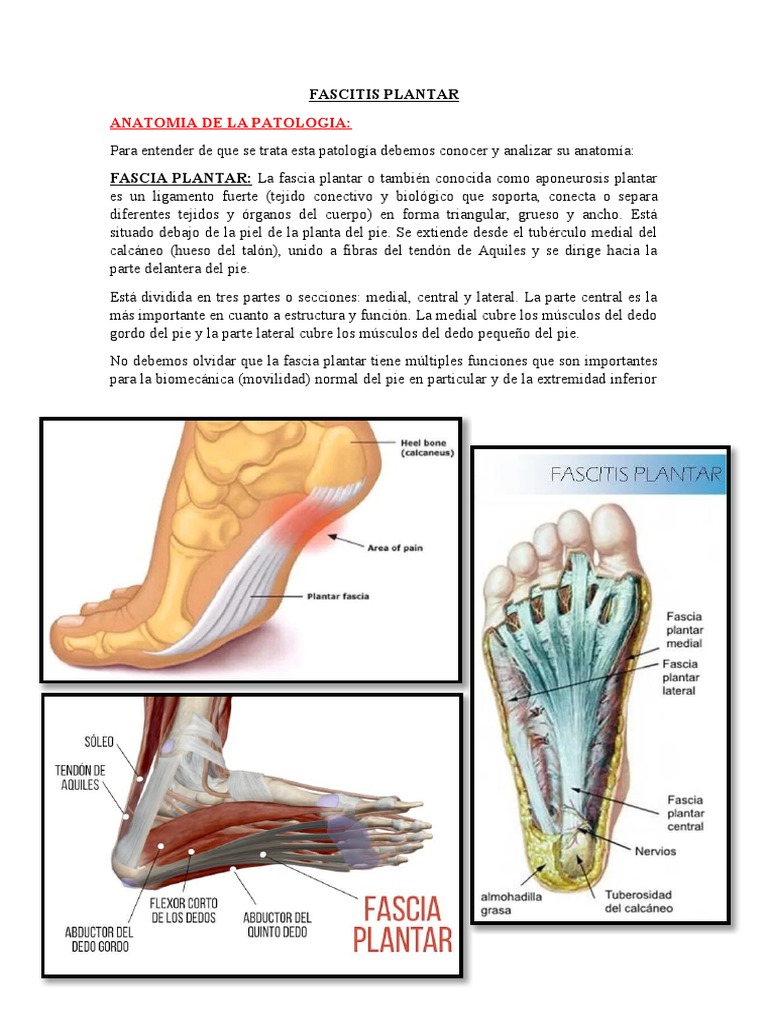 Anatomía y Epidemiología de la Fascitis Plantar | PDF