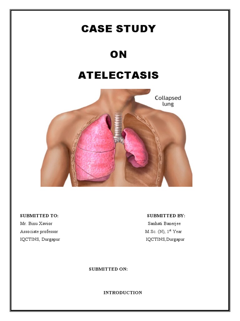 Atelectasis Case Study | PDF | Lung | Respiratory Tract
