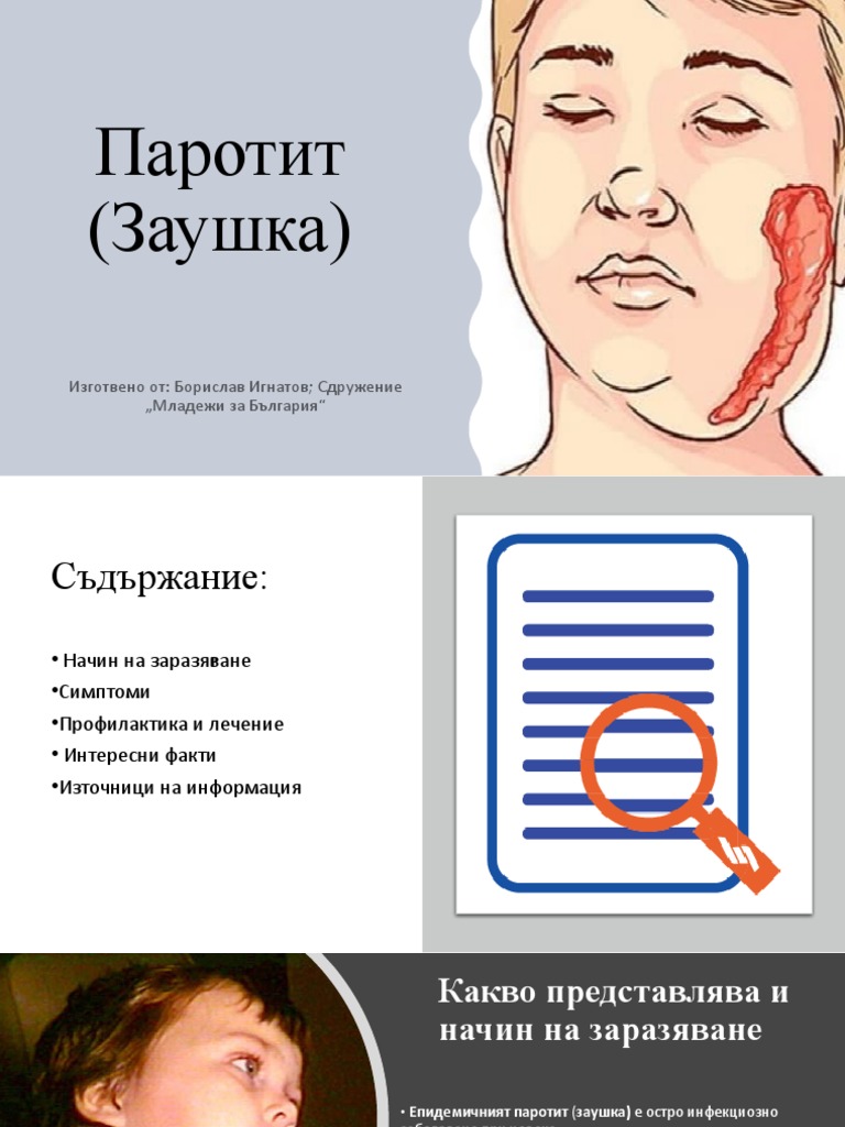 Mumps and How To Prevent Presentation | PDF