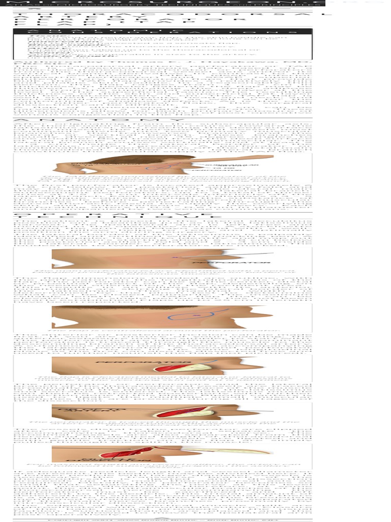 Thoracodorsal Artery Perforator Flap (TAP Flap) | PDF | Human Anatomy ...